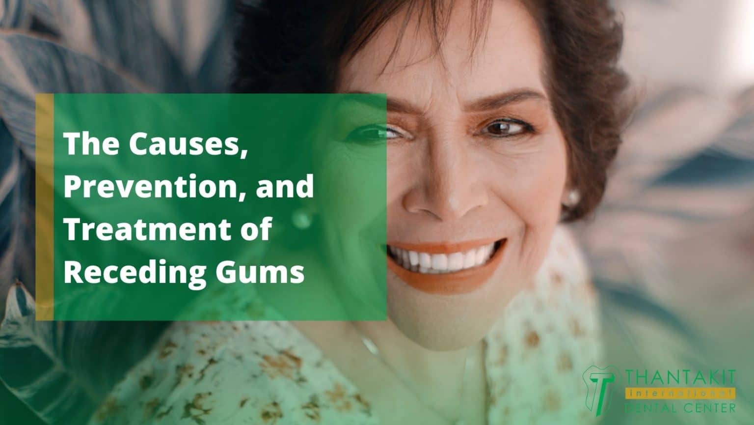 The Causes, Prevention, and Treatment of Receding Gums