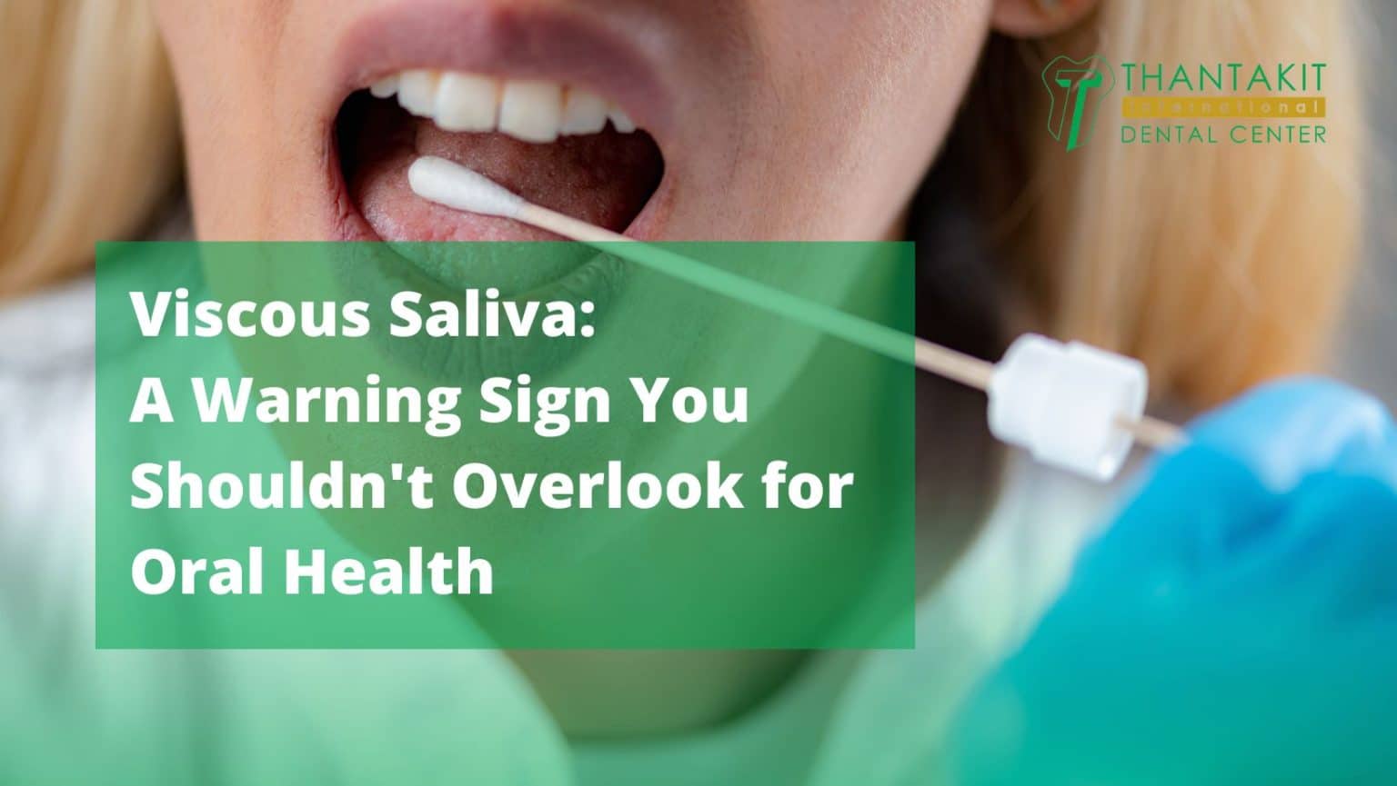 Viscous Saliva: A Warning Sign You Shouldn't Overlook
